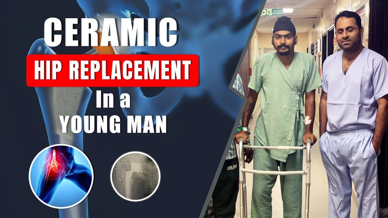 Ceramic Hip Replacement Journey for Young Patients | Story In a Young ...