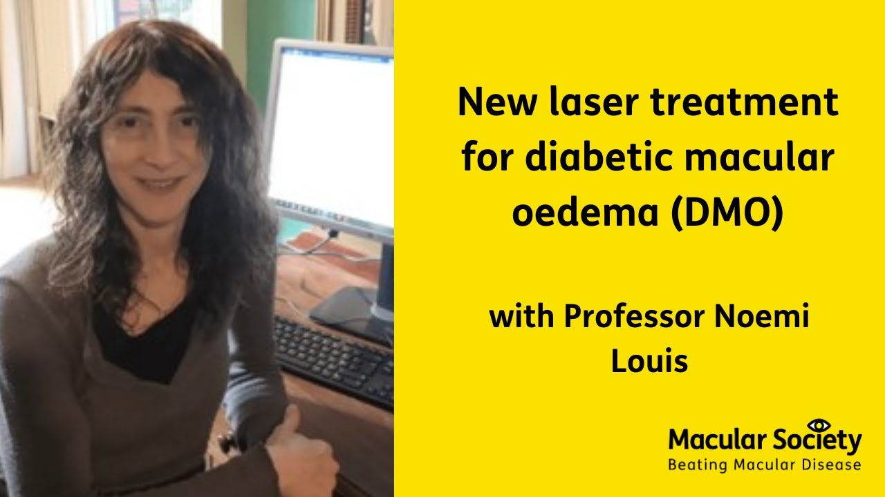 New laser treatment for diabetic macular oedema (DMO) - YouTube