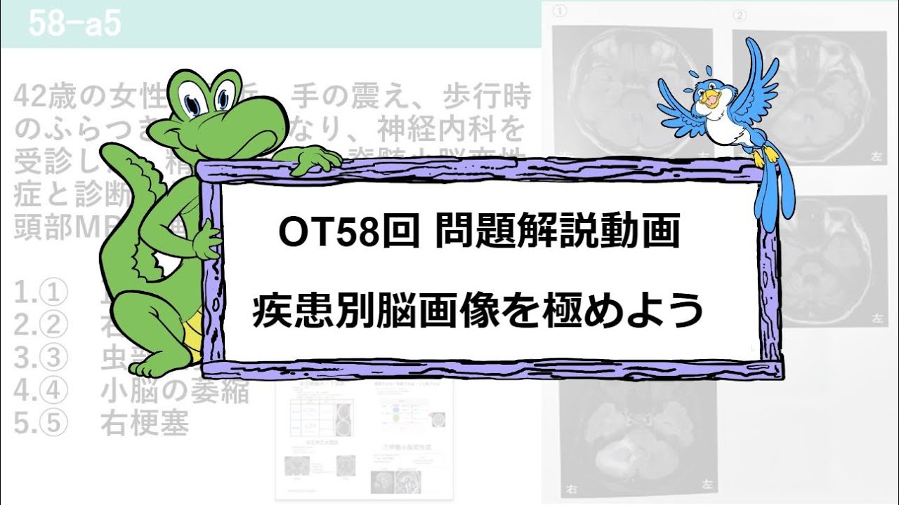 【OT58回国試問題】 疾患別脳画像を極める！解説動画 - YouTube