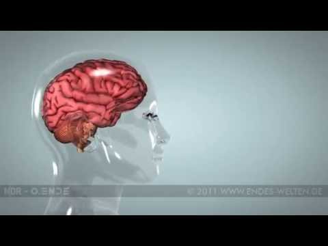 3D medical animation brain cancer hirn tumor - YouTube
