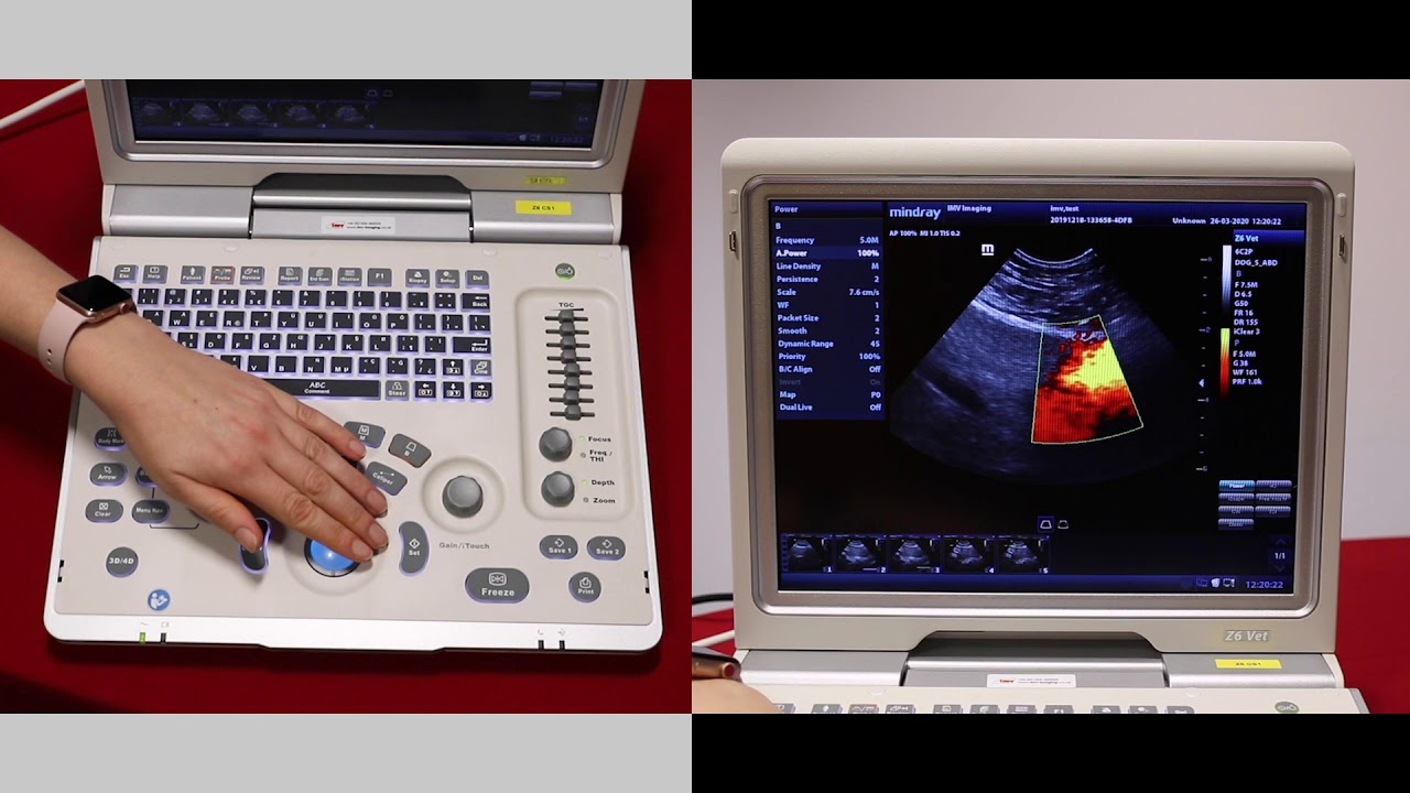 Mindray Z6: Basic overview of Doppler modes, M mode and ECG on the Z6 ...