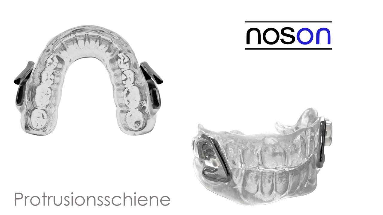 Noson Swiss High-Tech Mandibular Device (MAD) helps against sleep apnea ...