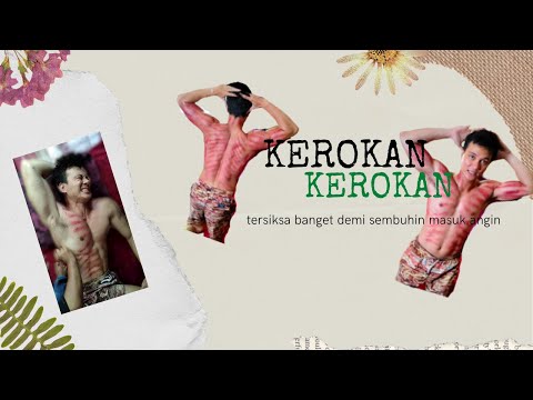 Terapi kerokan tradisional jawa atasi masuk angin part2 | kerokan full badan merah parah sampe lecet