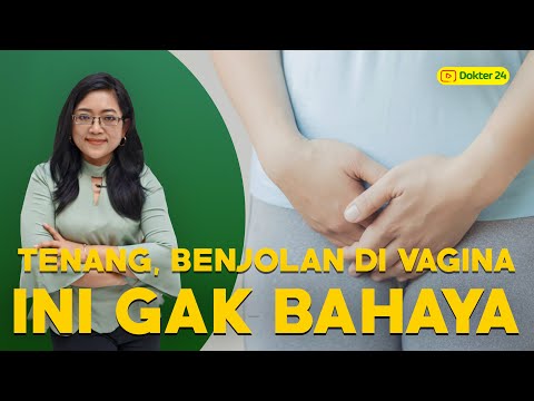 Dokter 24 - Jenis Benjolan di Vagina yang Tidak Berbahaya!
