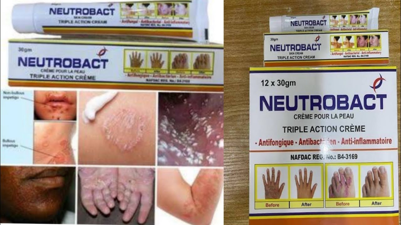 NEUTROBACT SKIN CREAM, TRIPPLE ACTION CREAM FOR FAST REMOVAL OF WHITE ...