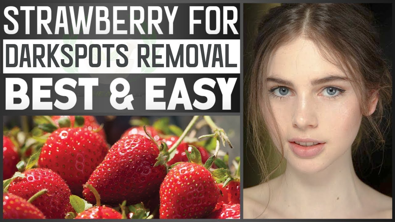 How To Remove Dark Spots | How To Clear Skin | Dark Spots On Face ...