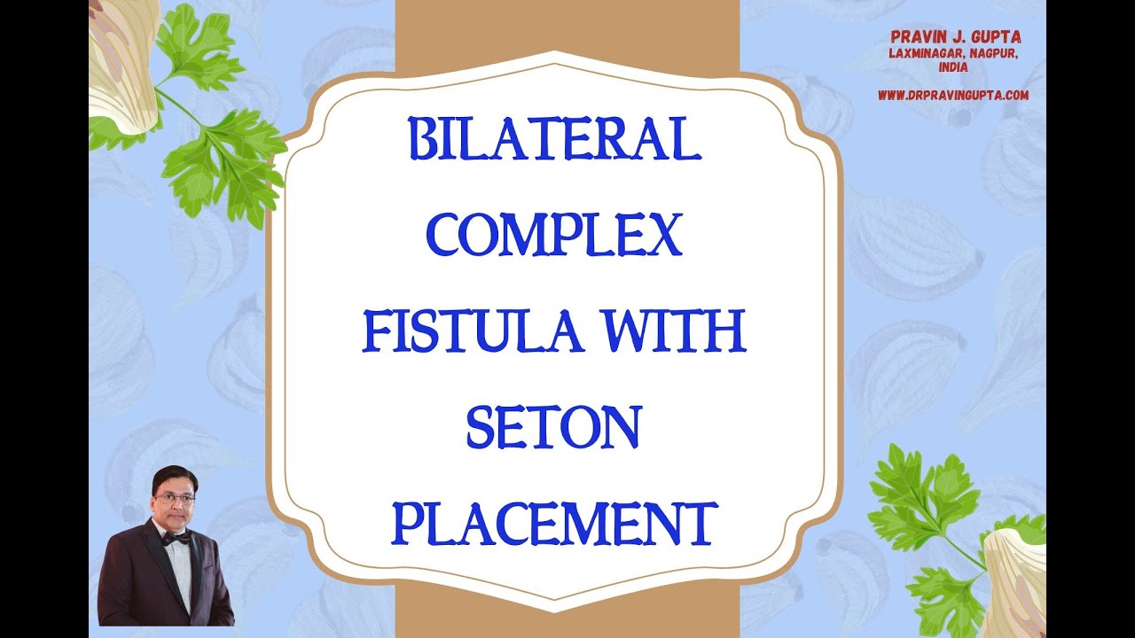 BILATERAL COMPLEX FISTULA WITH SETON PLACEMENT - YouTube