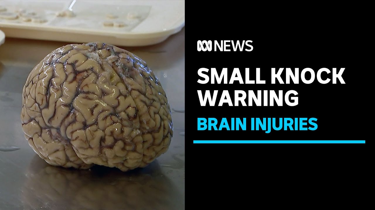 Calls to protect children from repeat head knocks in high contact ...