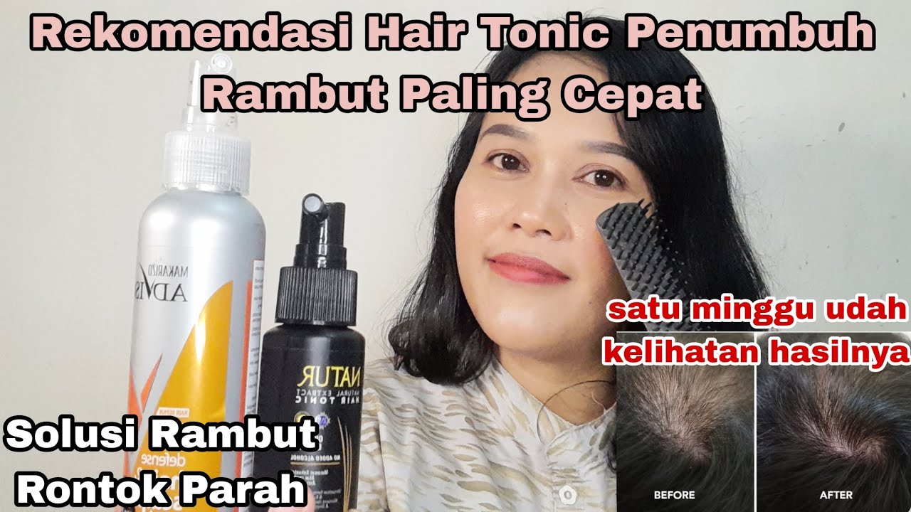 REKOMENDASI HAIR TONIC PENUMBUH RAMBUT PALING CEPAT - YouTube