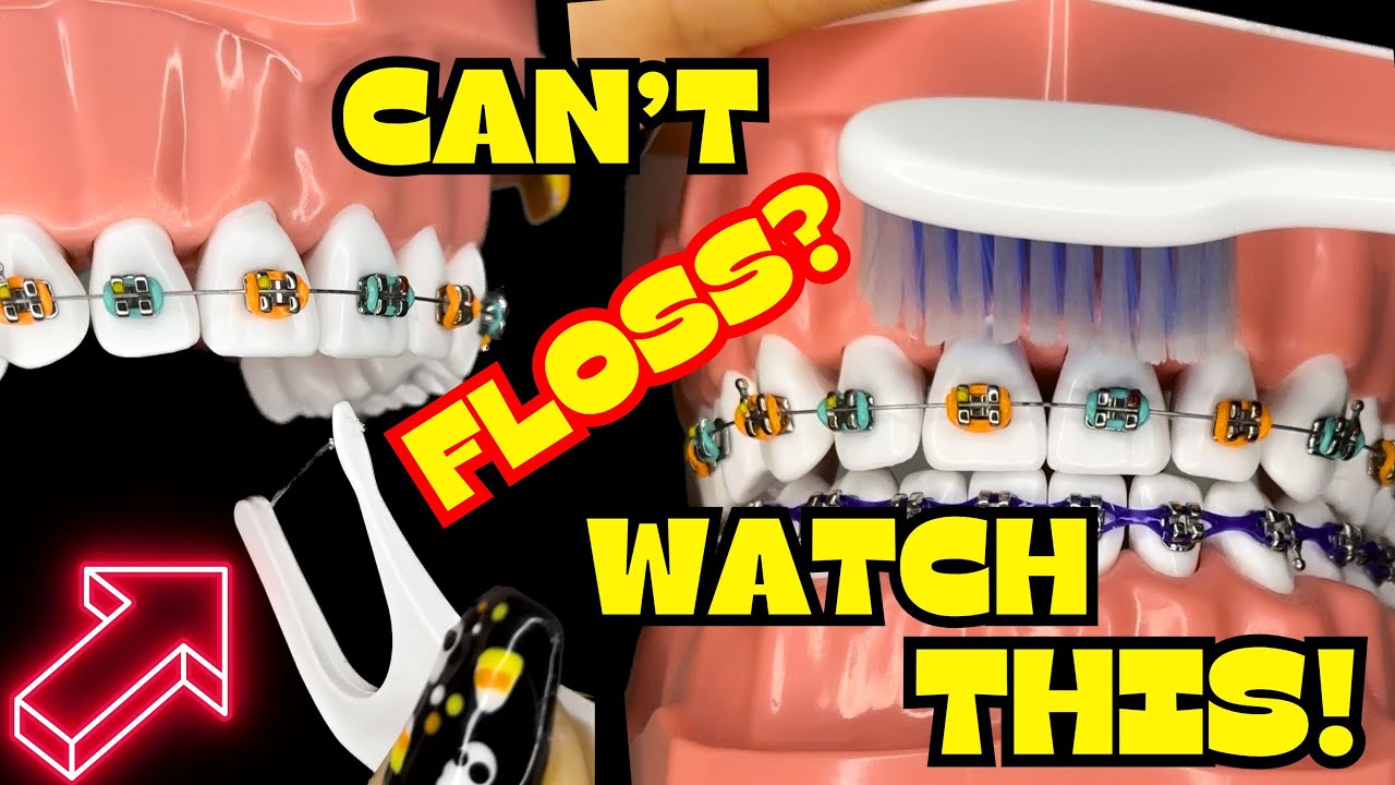 How to BRUSH and FLOSS your TEETH with BRACES ON * TUTORIAL ...
