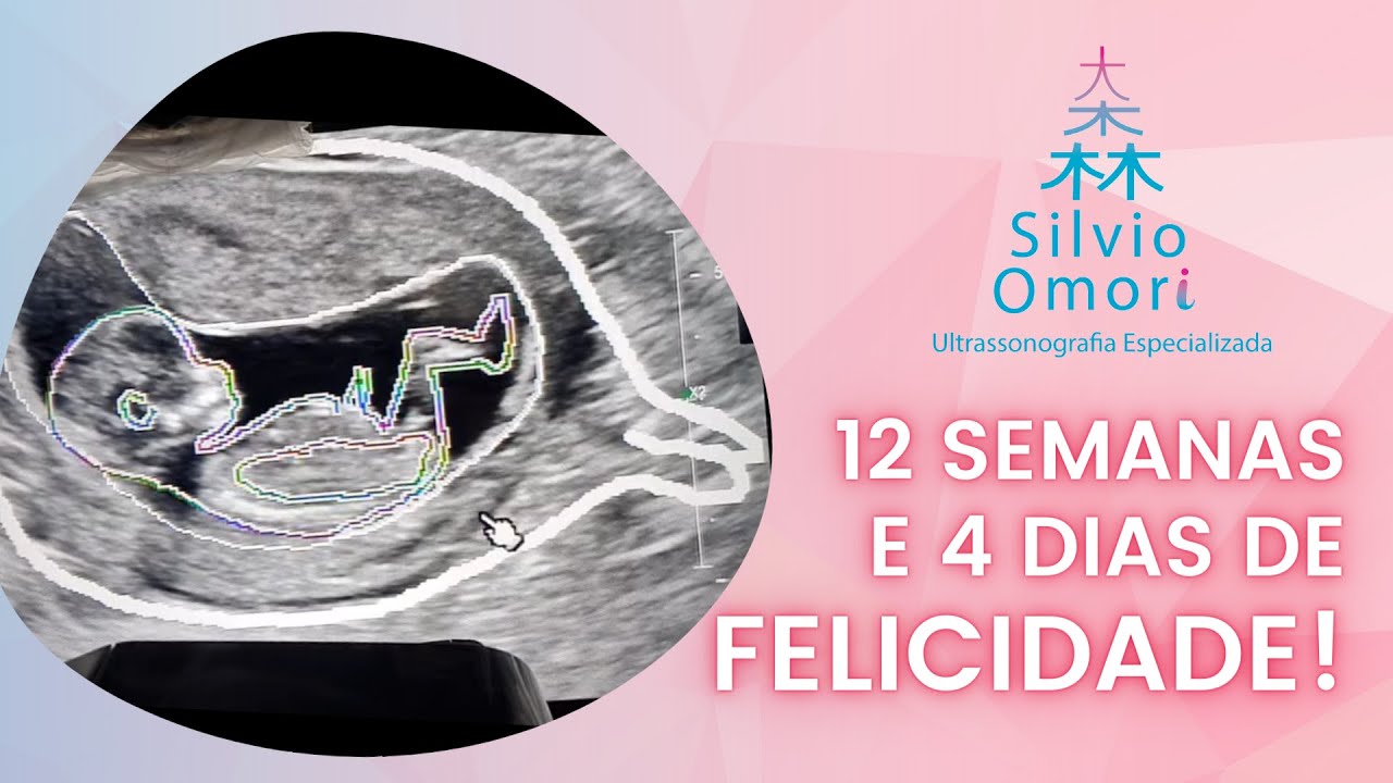 Ultrassom gravidez 12 semanas. Este bebê já é sucesso! - YouTube