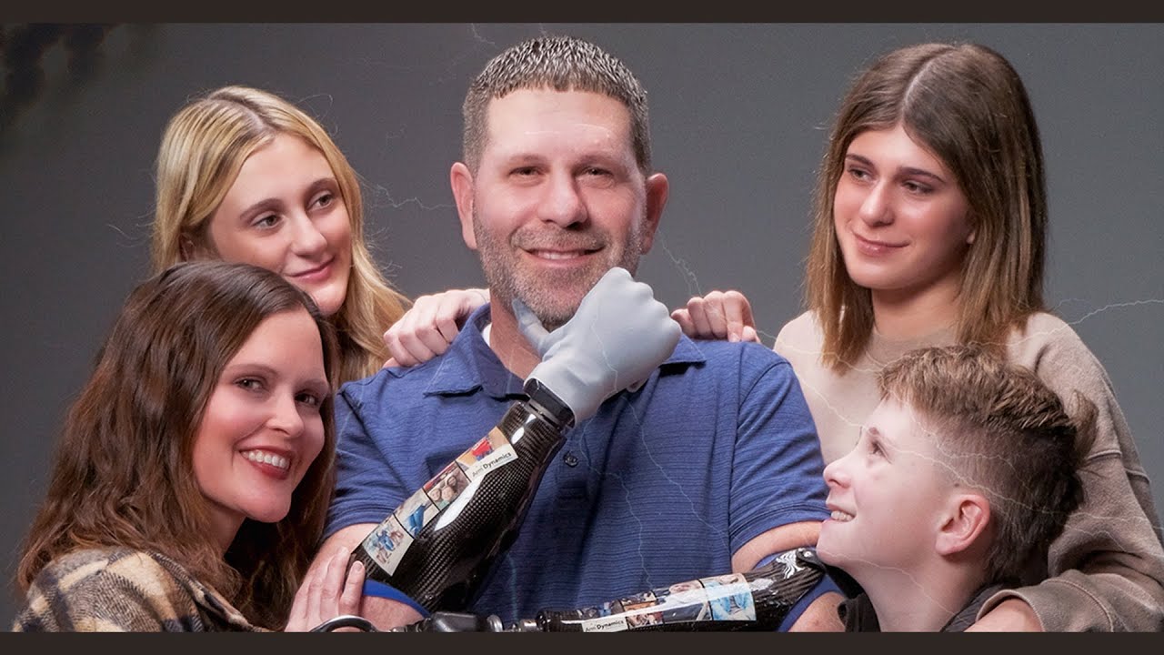 JASON KOGER: First Bilateral Arm Amputee in the World to Receive 2 ...
