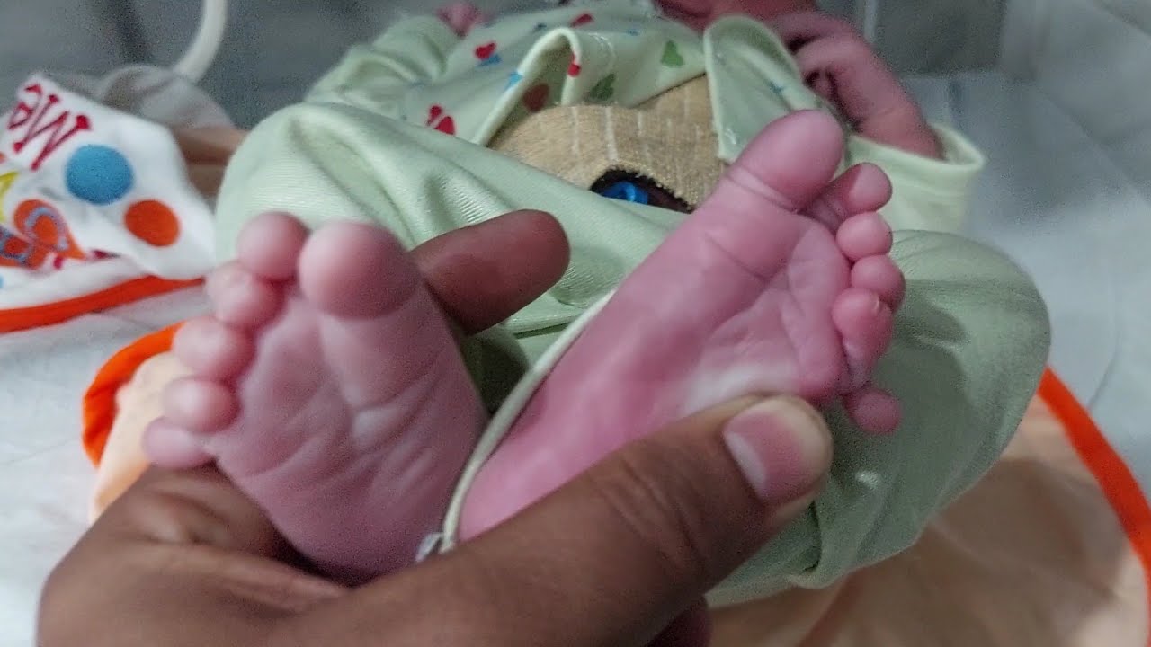 Cute baby birth with 6 fingers , Rare baby born @medicalpoint8024 - YouTube