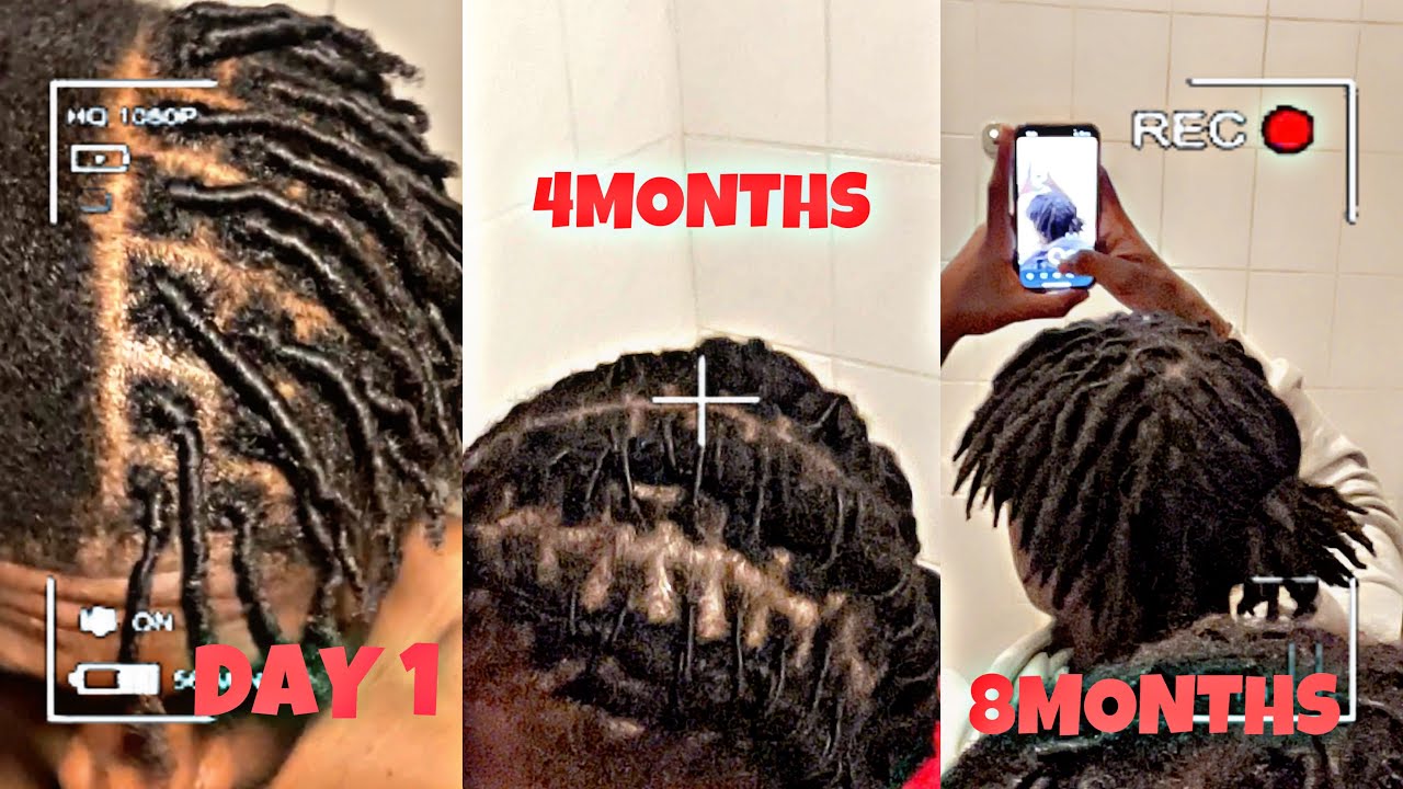 8 Months Starter Locs/ Dreadlocks Journey *Trust the Process* - YouTube