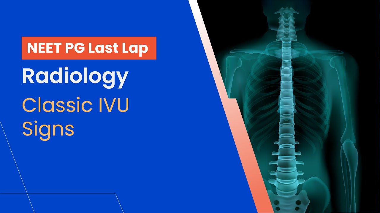 NEET-PG Prep : Classic IVU Signs explained by Dr. Abhishek Jha - YouTube