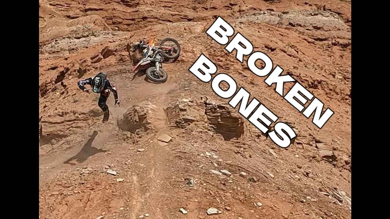 BROKEN BONES - YouTube