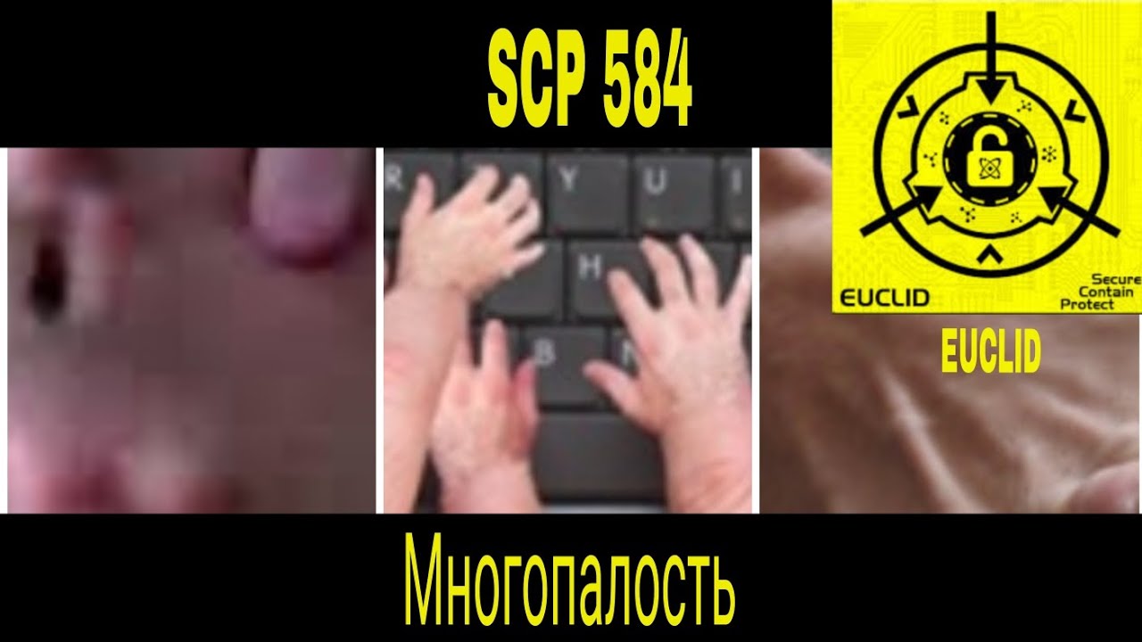 SCP-584 - Многопалость рассказ - YouTube