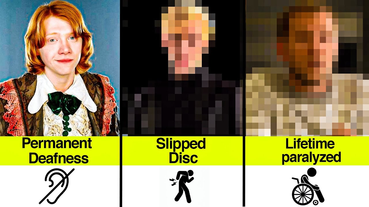 Harry Potter Actors Who Got LIFELONG Disabilities From Filming - YouTube