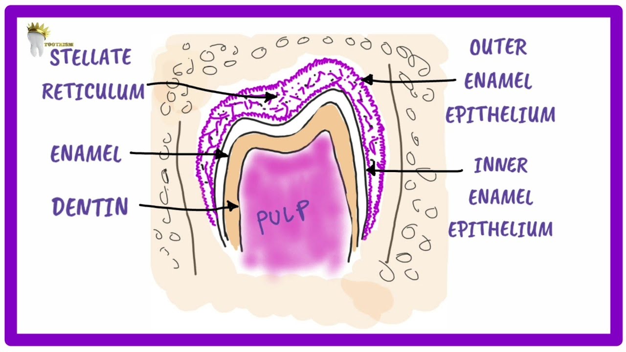 Oral Pathology Dentigerous Cyst Formation Youtube