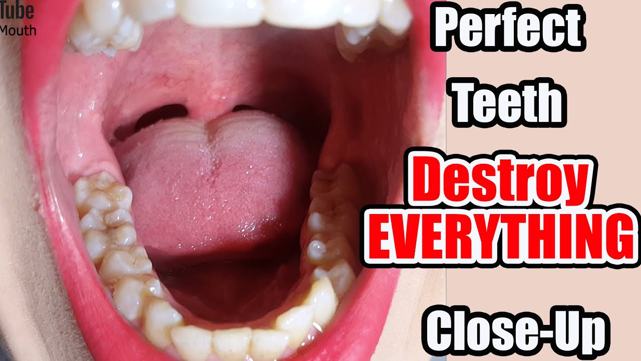 Perfect Teeth Destroy EVERYTHING Close Up Incisors, Canines & Molars ...