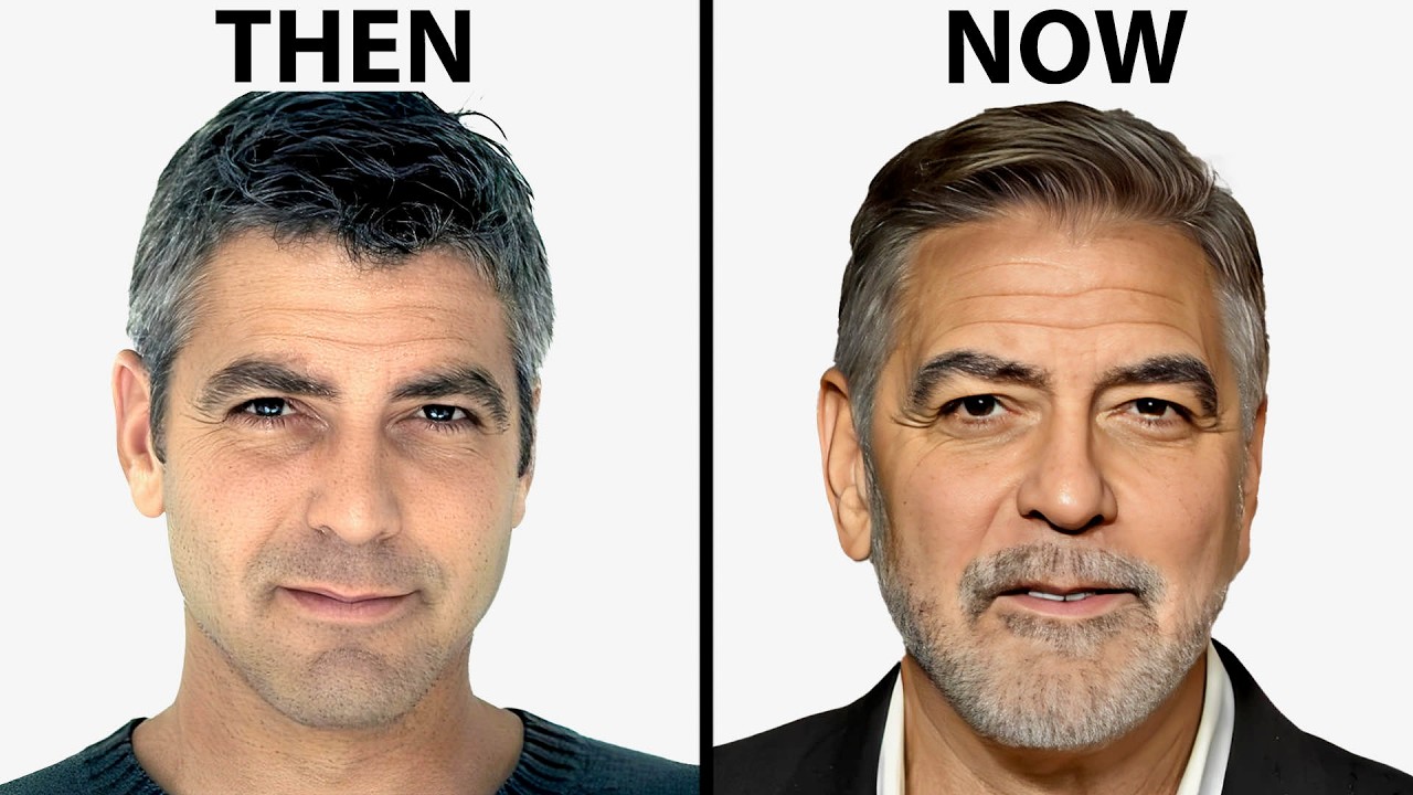 George Clooney's NEW FACE | Plastic Surgery Analysis - YouTube