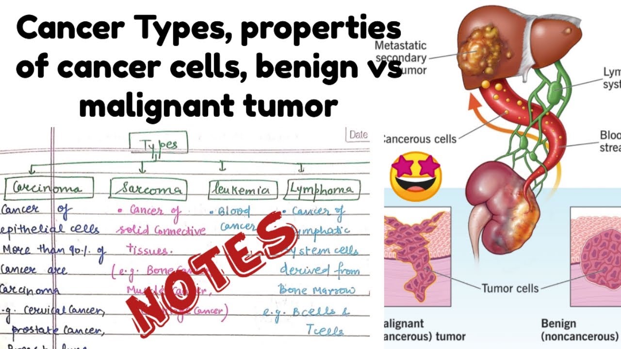 Cancer (Types, Benign & Malignant tumor; Properties of Cancer cells) # ...