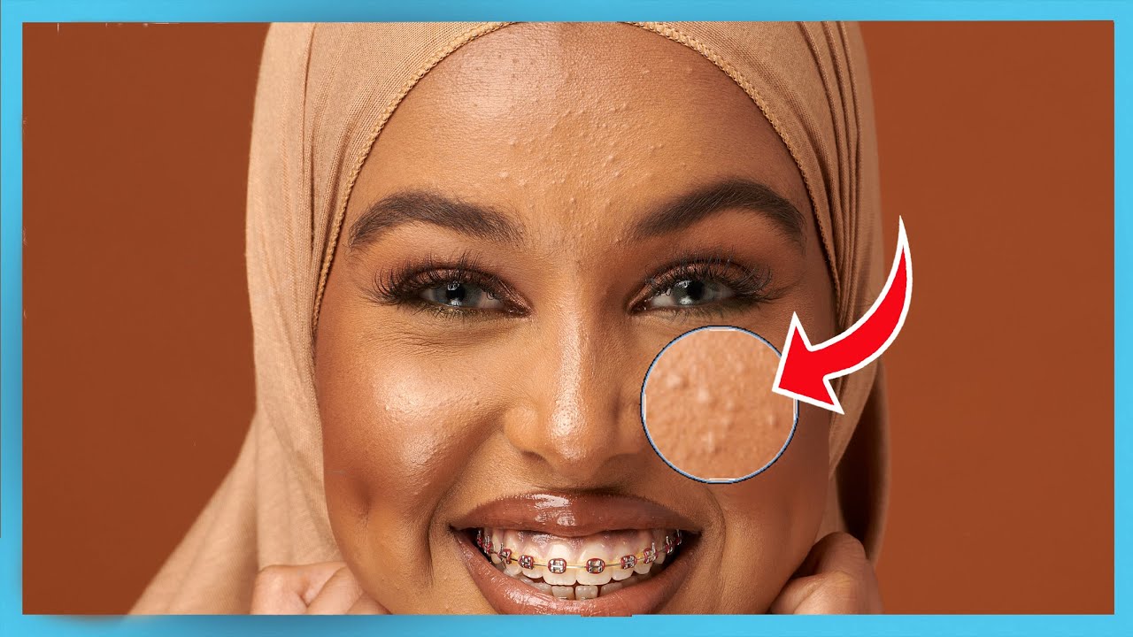 5 Effective Ways to remove Blemishes in Photoshop - YouTube