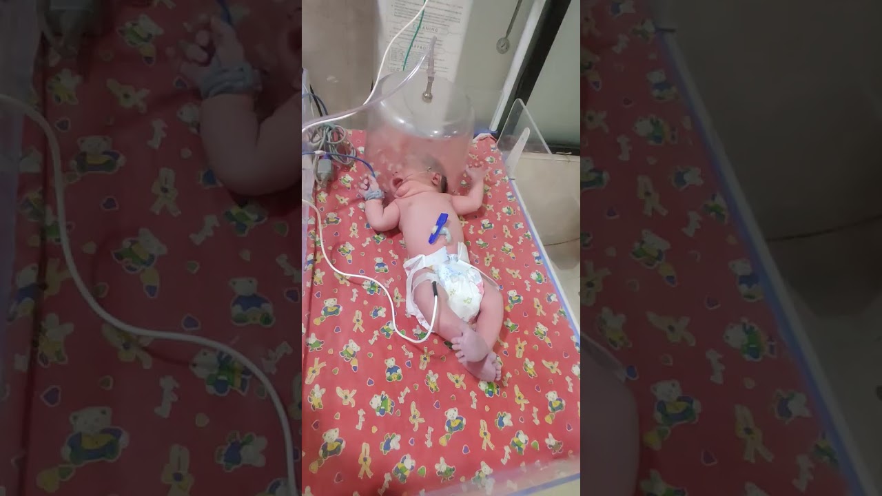 just born baby new born lscs - YouTube