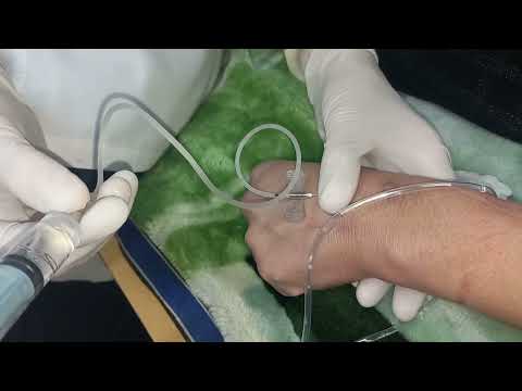 Intravenous injection through a butterfly catheter - YouTube