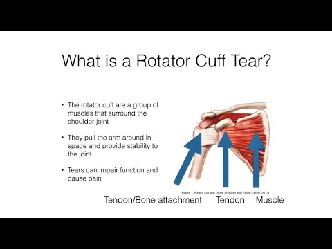 Howard Routman, DO — Preparing for Rotator Cuff Surgery - YouTube