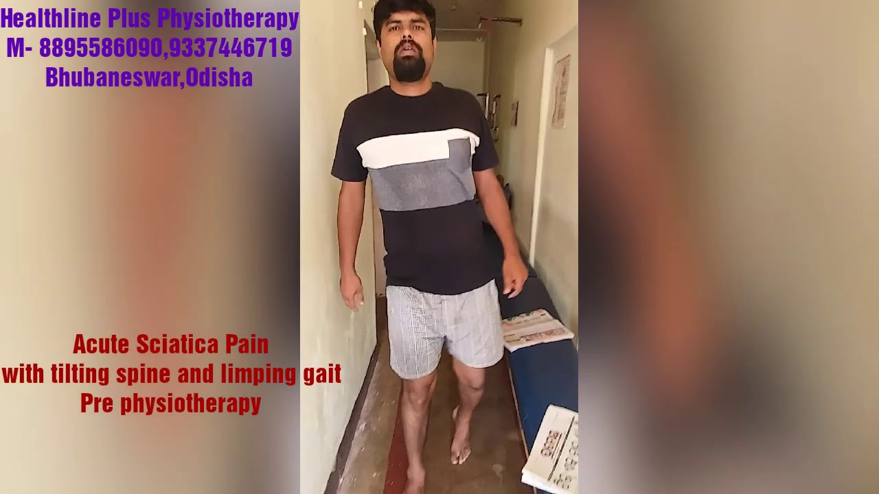 Acute Sciatica Pain||limping movement||recovered by Dr Bimal Dey(PT)# ...