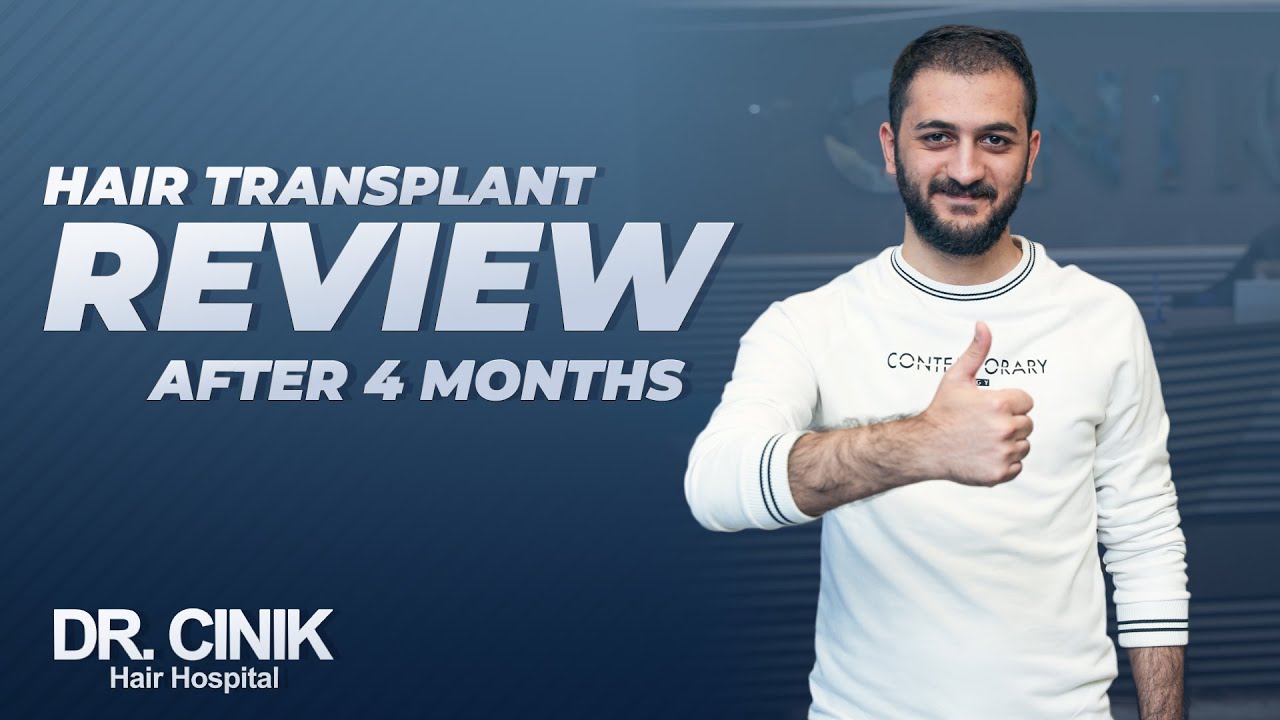 Hair Transplant Review After 4 Months | Hair Transplant | Dr. Emrah ...