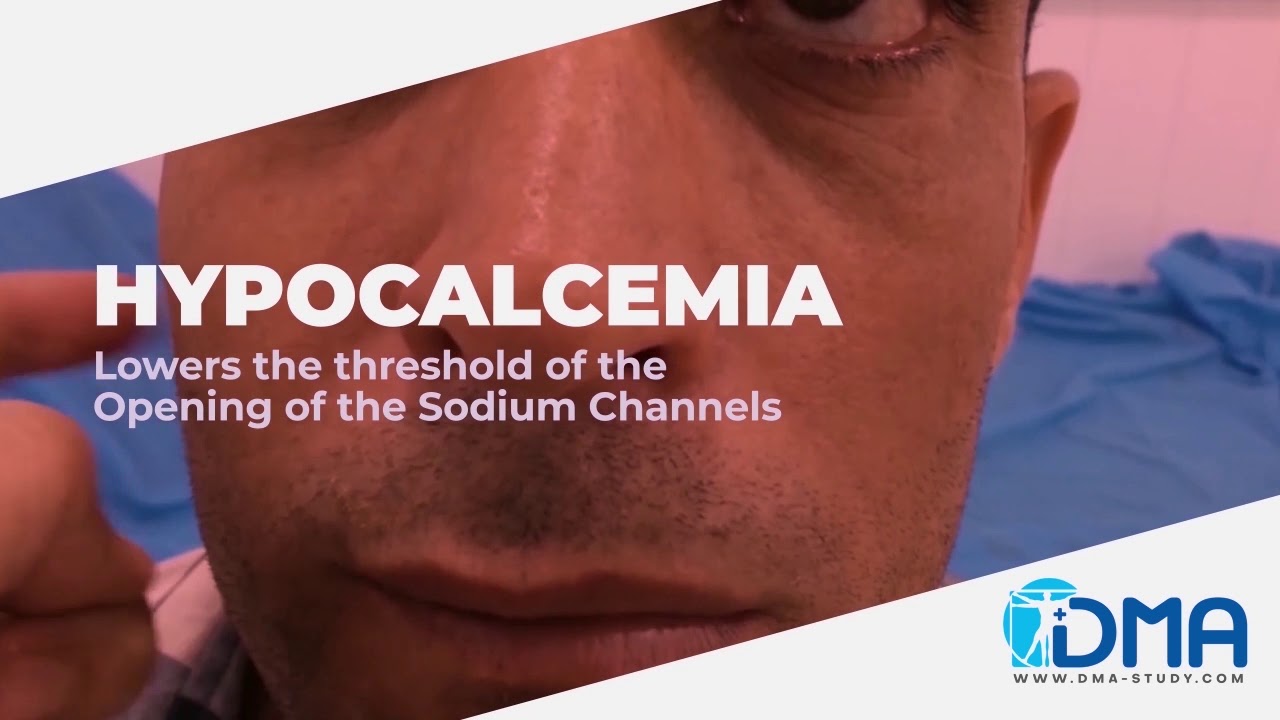 CHVOSTEK'S SIGN I SEMIOPEDIA: PATHOPHYSIOLOGY OF MEDICAL SEMIOTICS I DR ...