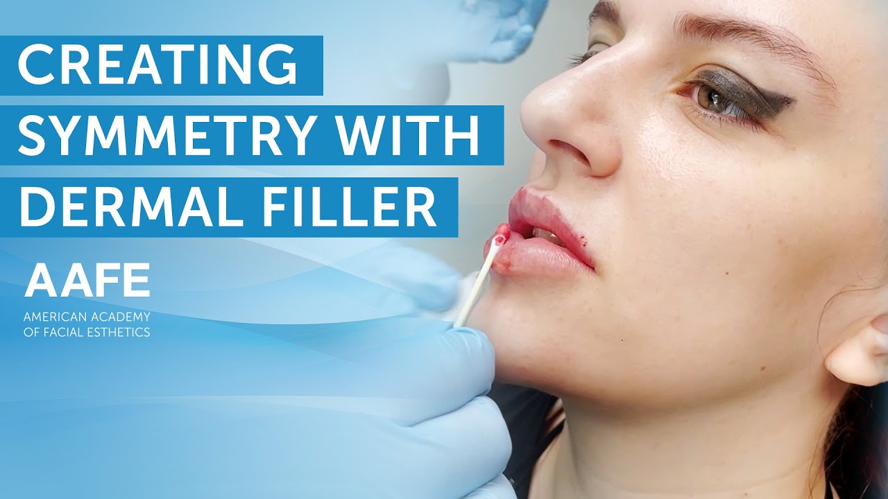 Creating Lushes Lips with Dermal Filler | AAFE - YouTube