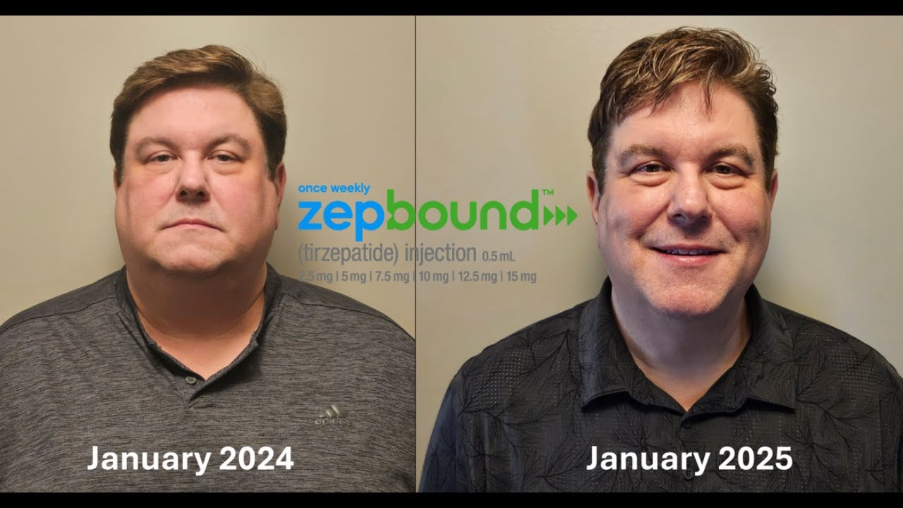 My Weight Loss Journey with Zepbound | Episode 9 | 1 Year Update - YouTube
