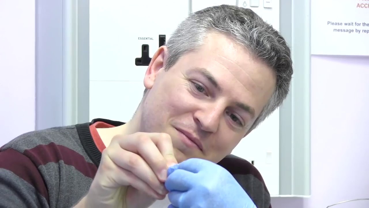 BEST3 Cytosponge trial Barrett's Oesophagus Screening Research Cancer ...