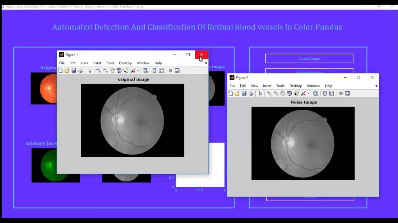 Retinal blood vessels matlab projects - YouTube
