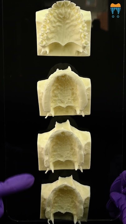 Jaw Development Made Easy with iDENTical Models! #shortsfeed #dentist ...