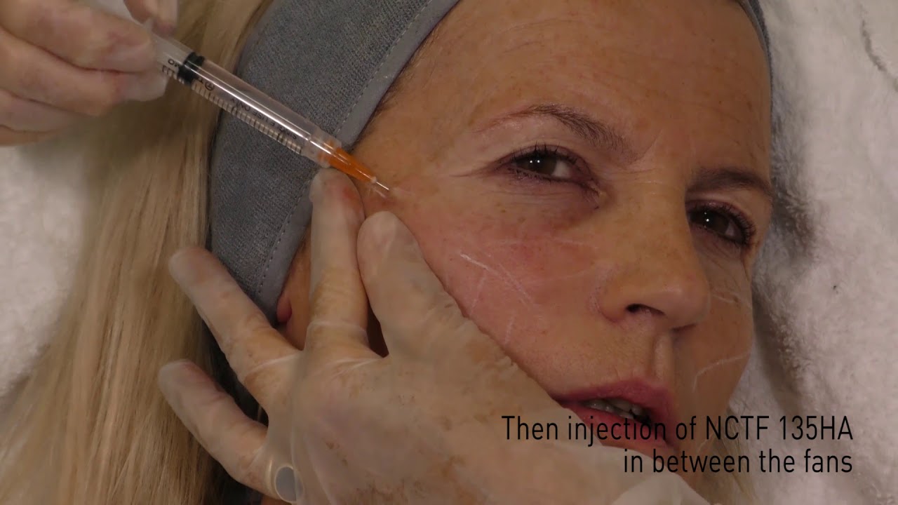 BIO NUTRI LIFT - YouTube