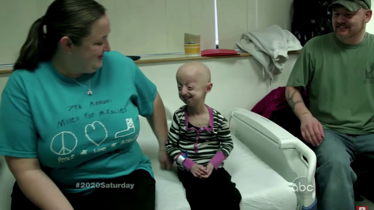 Hutchinson Gilford Progeria Syndrome video - YouTube