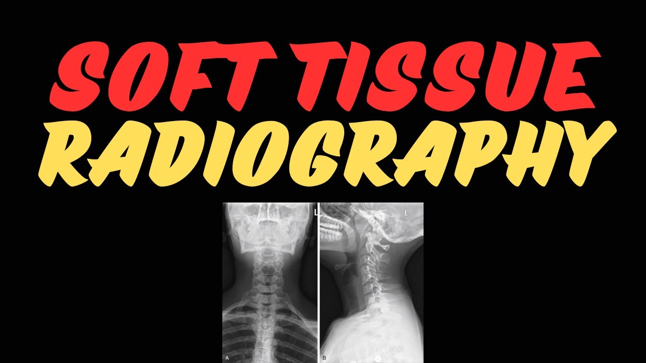 Soft tissue Radiography| low kVp techniques | x ray soft tissue ...