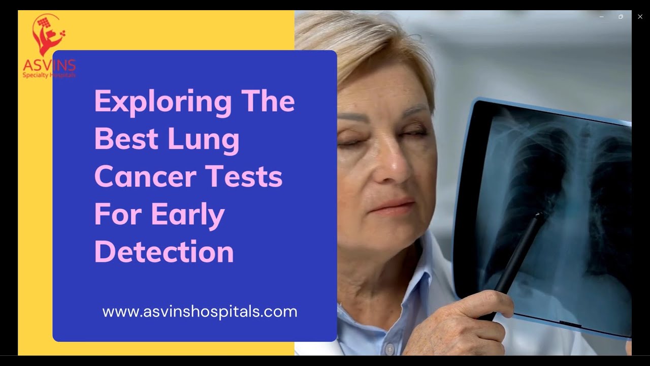 Exploring The Best Lung Cancer Tests For Early Detection - YouTube