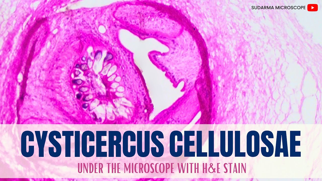 Cysticercus cellulosae under the microscope with Haematoxylin and Eosin ...