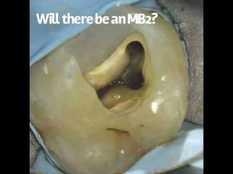 How to find MB2? - YouTube