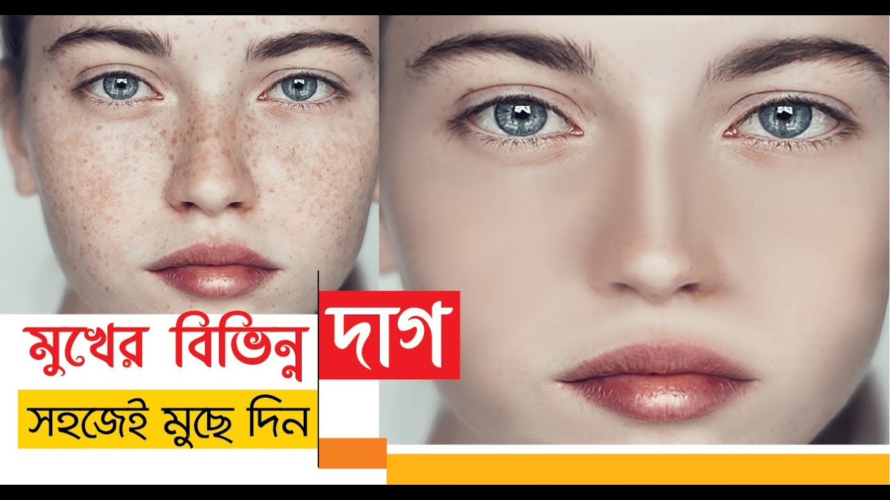 How To Remove Spots From Face In Photoshop Cc Photoshop Tutorial 2020 SkipTECH Pro YouTube how-to-remove-spots-from-face-in-photoshop-cc-photoshop-tutorial-2020-skiptech-pro-youtube