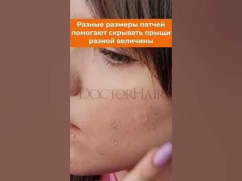 Sevich (Севич) Патчи от прыщей и акне, заживляющие пластыри против ...