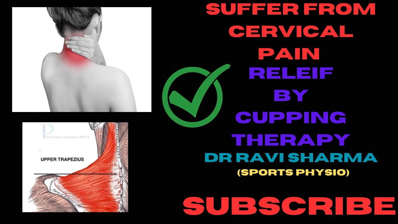 Relief from Cervical pain || Cupping therapy || by Dr Ravi sharma (MPT ...