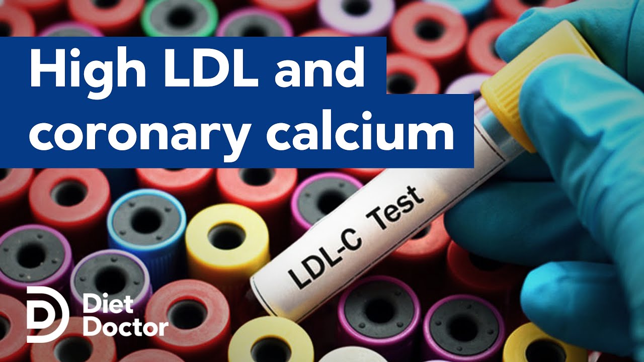 High LDL and coronary calcium - YouTube