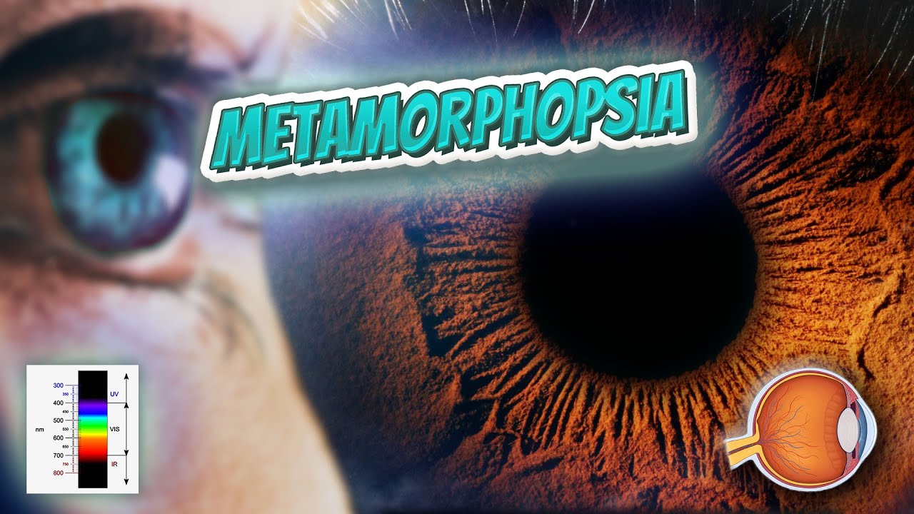 Metamorphopsia - Your EYEBALLS - EYNTK 👁️👁️💉😳💊🔊💯 - YouTube