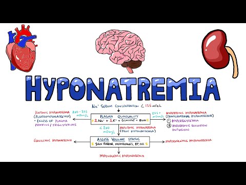 An Approach to Hyponatremia -  Hyponatremia Diagnostic Algorithm | Hyponatremia Causes MADE EASY